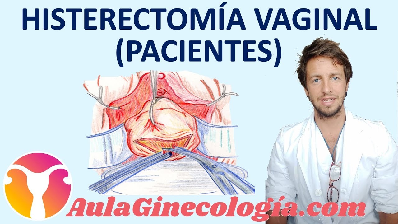 Beneficios de quitarse la matriz: ¿Por qué considerarlo?
