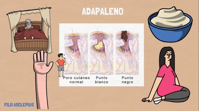 Beneficios del adapaleno para la piel