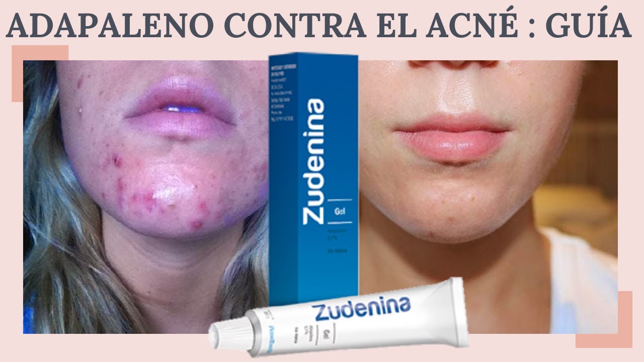 Beneficios de Zudenina Plus: ¿Por qué deberías usarlo?